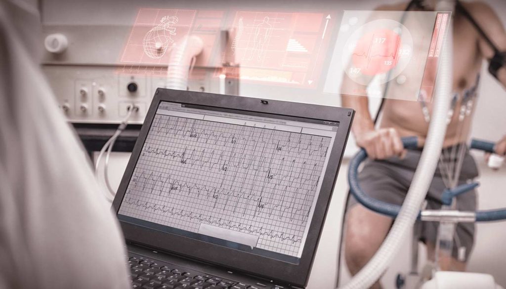 Stress Test (Exercise ECG) - Dr Ahmed Gheith